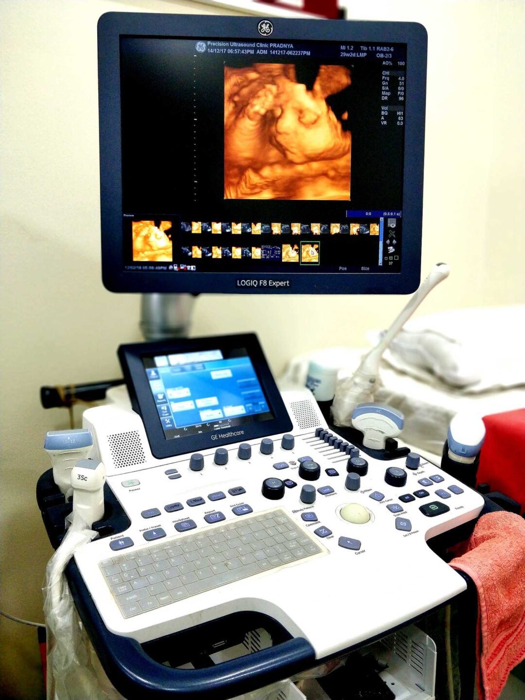 How to use the ultrasonography machine - meditechtips.com